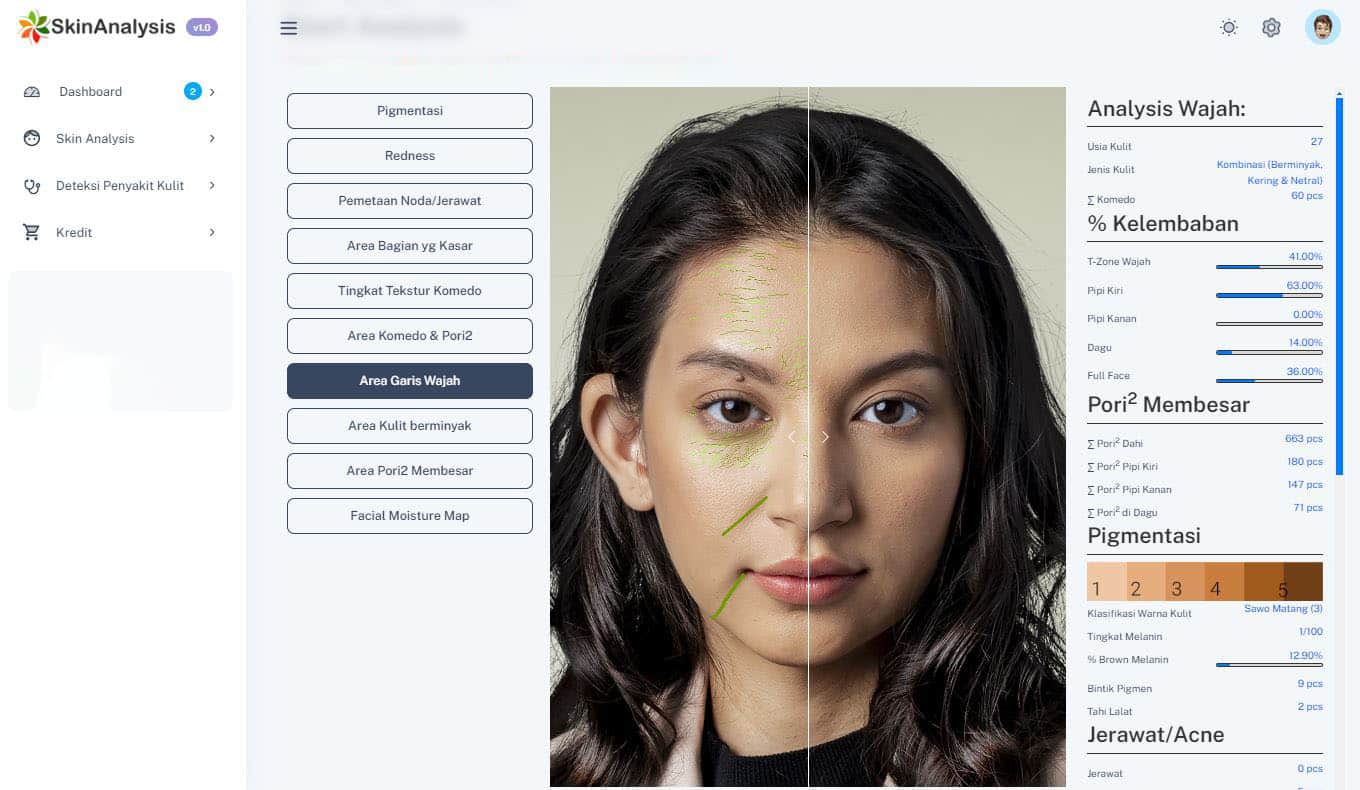 AI Skin Analysis: Analysis kulit dengan teknologi kecerdasan buatan
